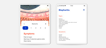 NEW OptiExpert™ v2.0 app. | CooperVision Denmark